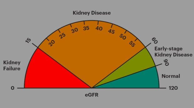 Can My GFR Get Better | Dr. Kavitha Gone Explains